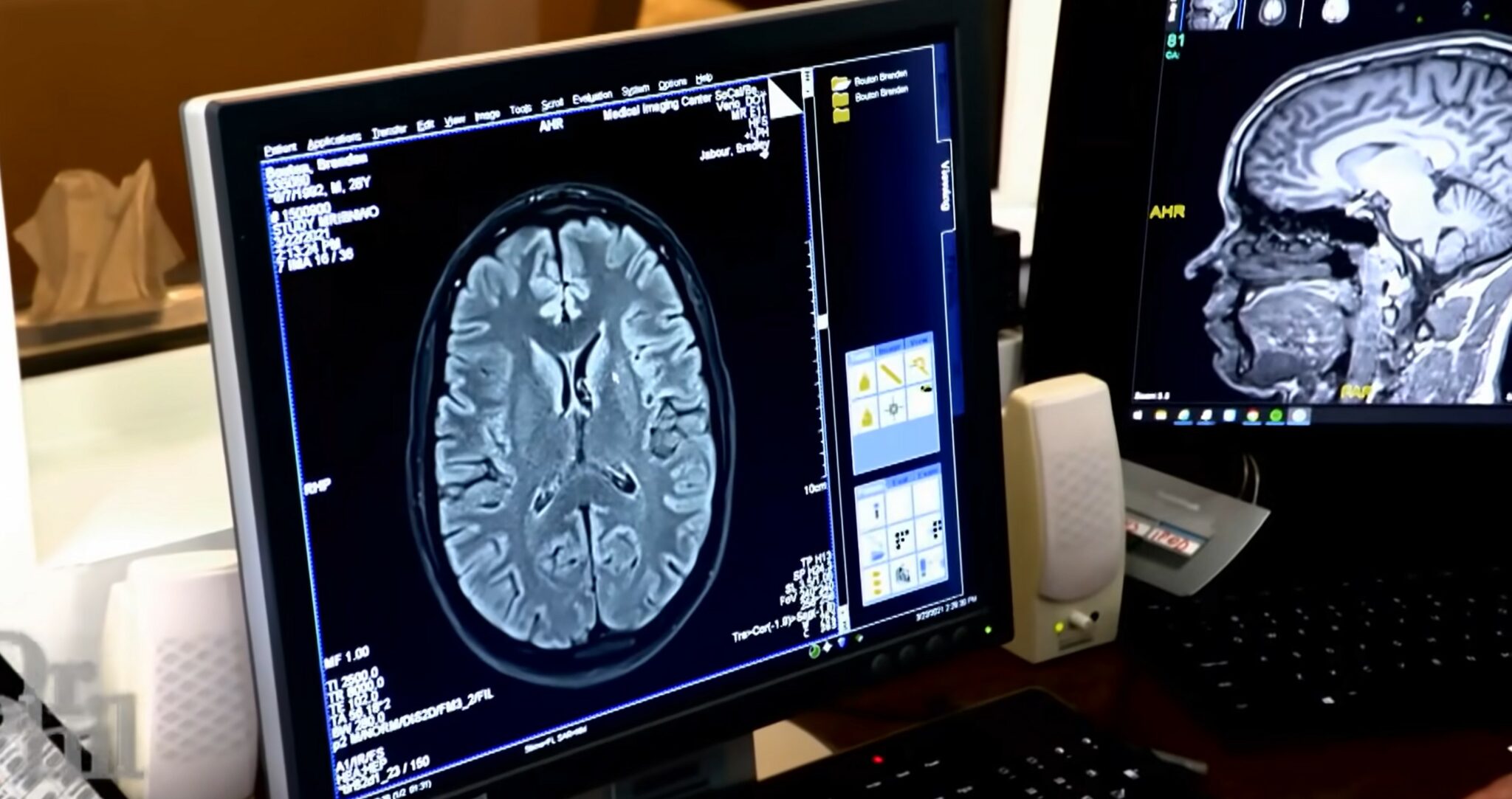 Man Struggling with Anger Management Issues Cries After Brain Scan ...