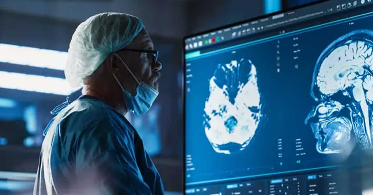 Neuroscientist Shares Insights on Removing 'Brain Waste' to Combat Dementia