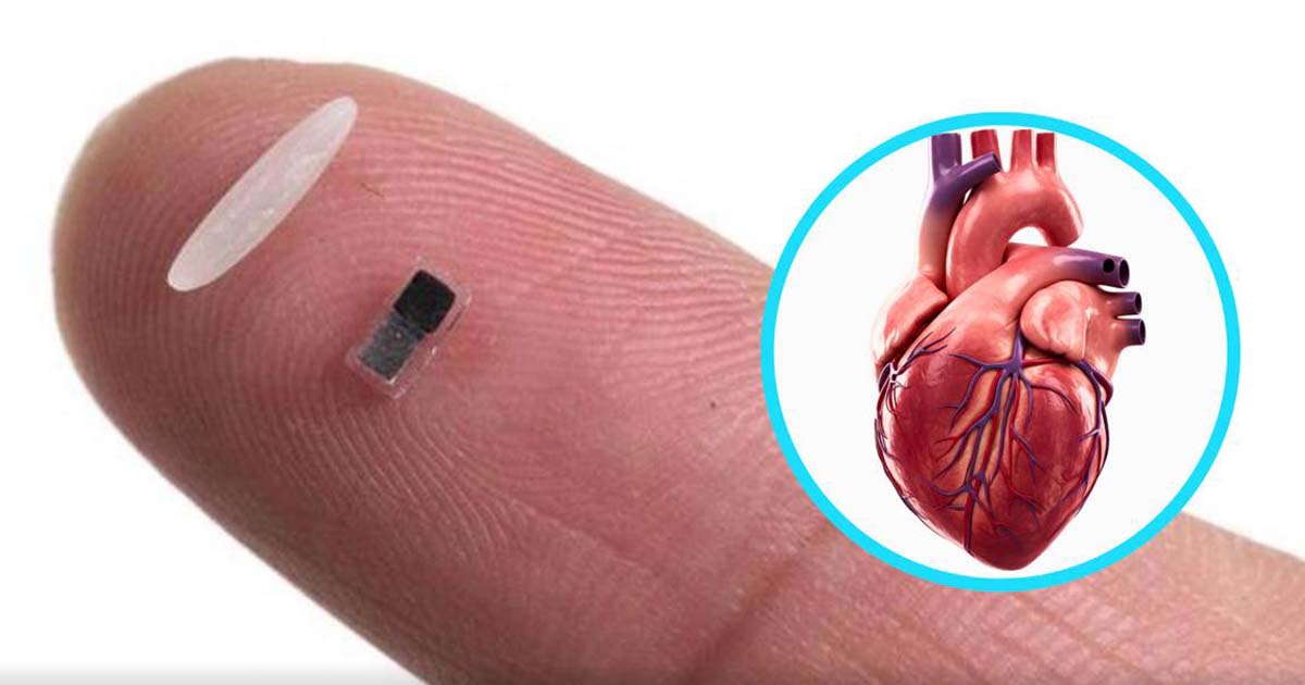 World's Smallest Pacemaker, the Size of a Rice Grain, Marks Major Medical Breakthrough