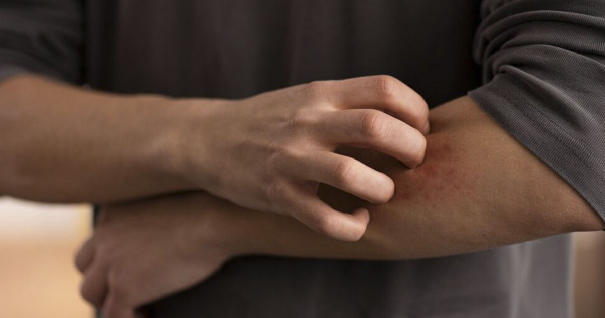 Itchy Red Spots on Your Skin? Don’t Ignore This Common but ...