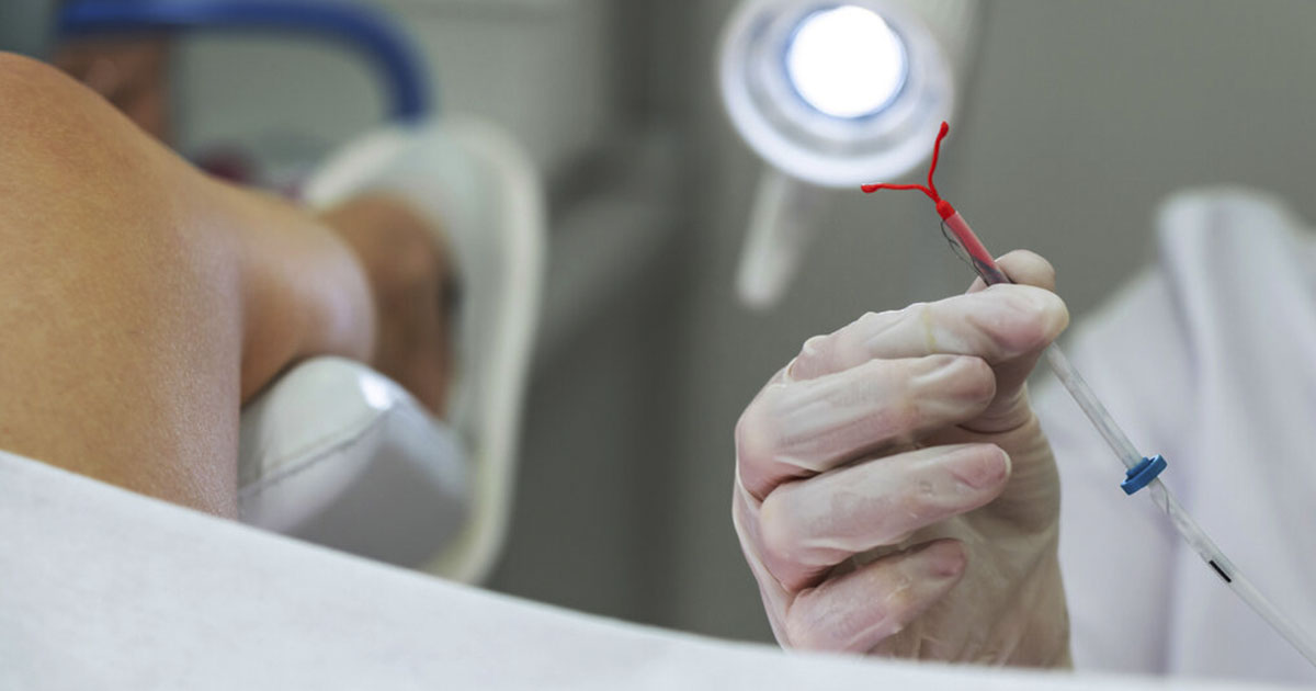 Updated Guidelines Urge Doctors to Address Pain During IUD Insertion