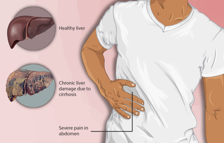 How Long It Takes Your Liver to Heal After Drinking
