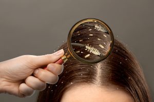 9 Possible Causes of Scalp Bumps (And When to Worry)