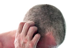 9 Possible Causes of Scalp Bumps (And When to Worry)