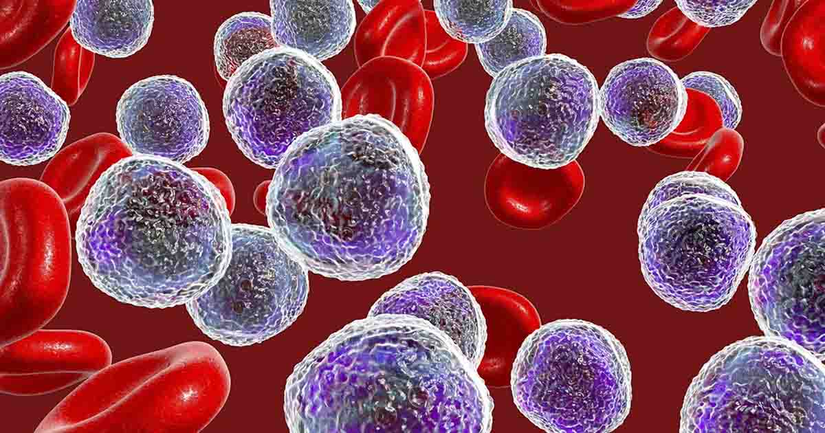 Rare But Deadly Skin Cancers That People Often Overlook