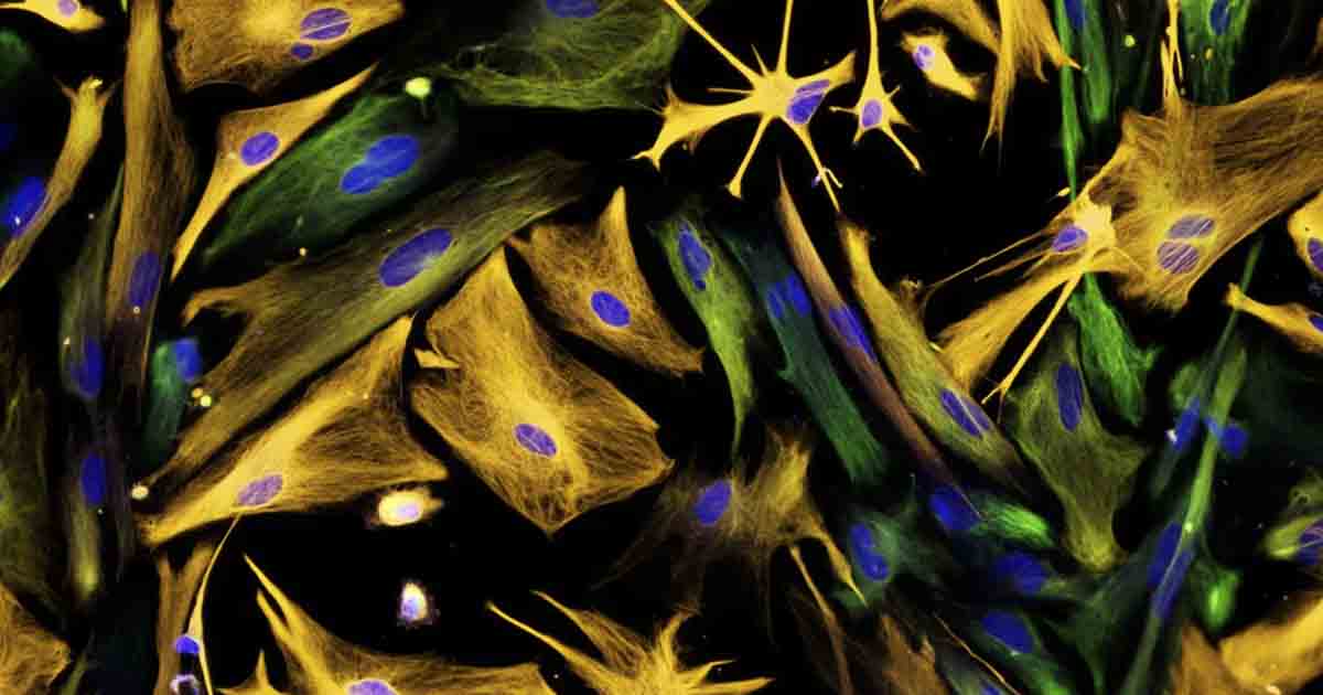 Study Confirms Adults Can Grow New Brain Cells, and They Found the Source