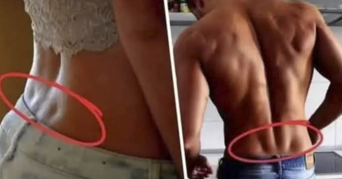 What Does It Mean if You Have Those Two Dimples On Your Lower Back?