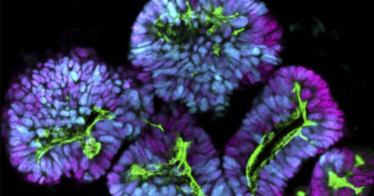 Study Unlocks Blueprint for Lab-Grown Kidney Cells